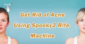 Get Rid of Acne Using Spooky2 Rife Machine - Spooky2